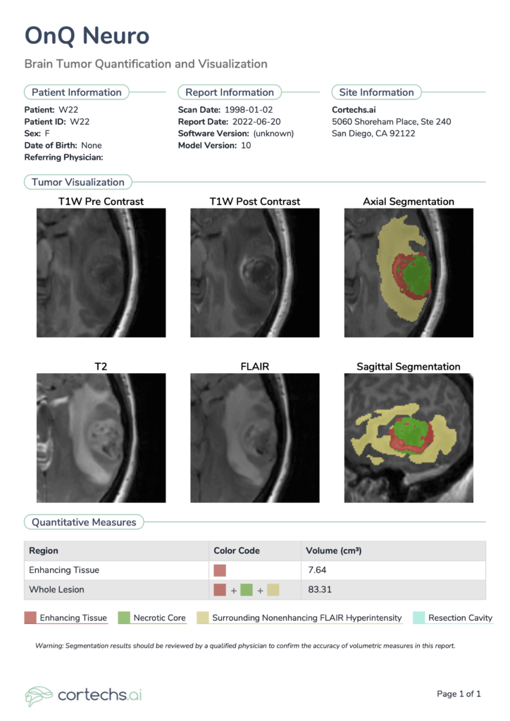 OnQ Neuro: Case Study – MedReport